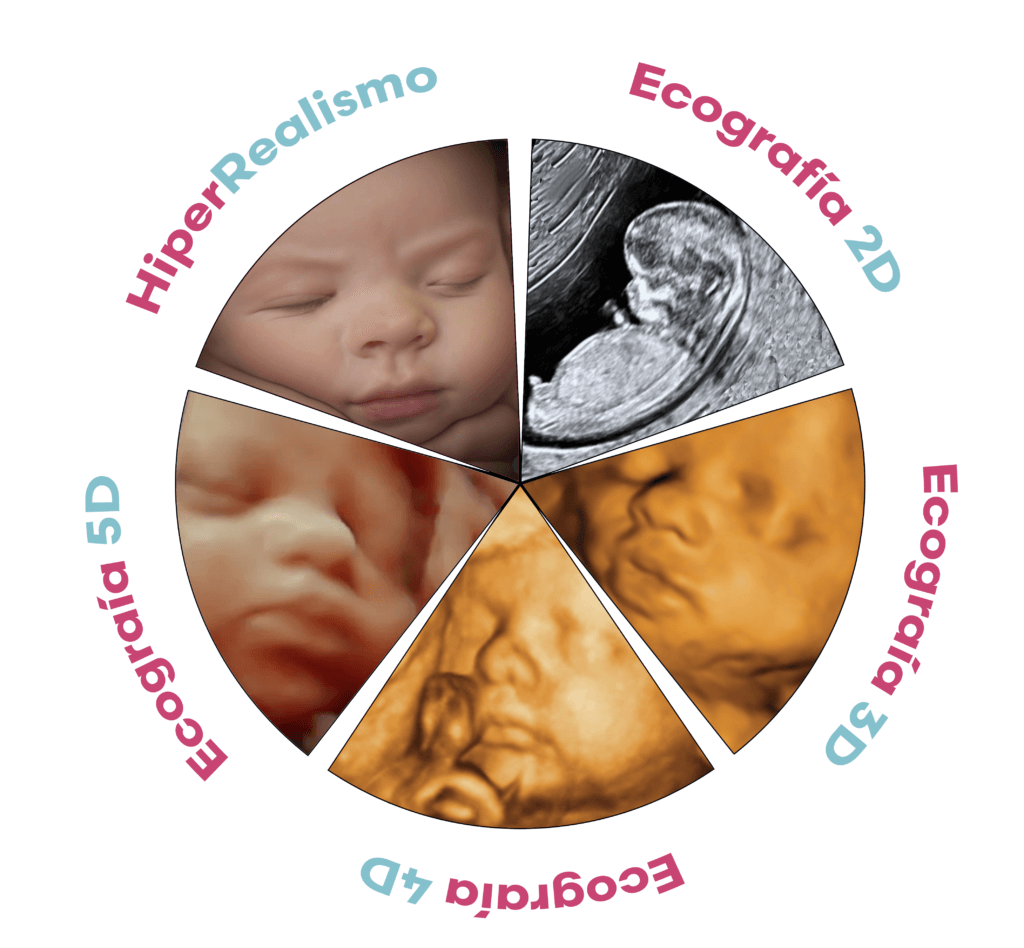 Diferencias entre ecografías 2D, 3D, 4D y 5D | Guía completa